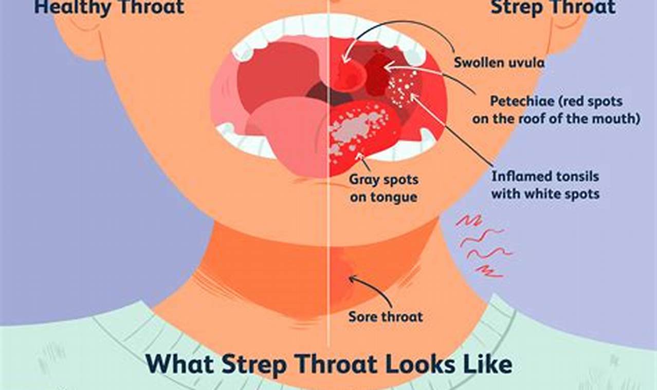 Solve Muffled Voice & Sore Throat: Causes & Relief Tips